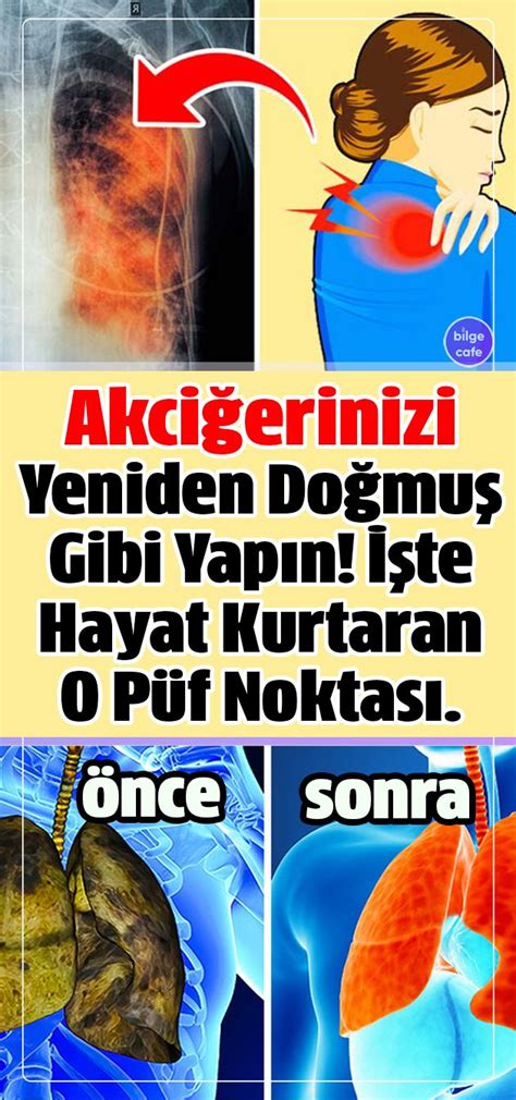 Akciğerlerinizi Seviyorsanız Bu 5 Konuda Taviz Vermeyin Bilgecafe Akciğerler Sağlık Sağlık