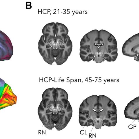 Qsm And Mwf Cortical And Myelin Mapping Left Top Average