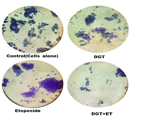 Clonogenic Assay Showing Colony Formation Of Mda Mb 231 Cells Treated Download Scientific