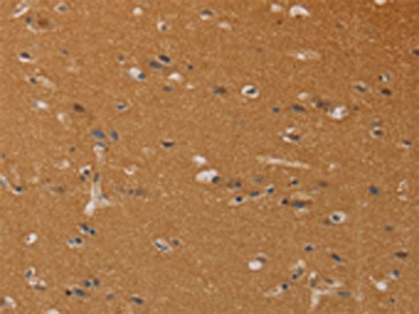 兔抗chrna4多克隆抗体anti Chrna4 Rabbit Polyclonal Antibody 生命科学产品与技术服务 生工生物工程