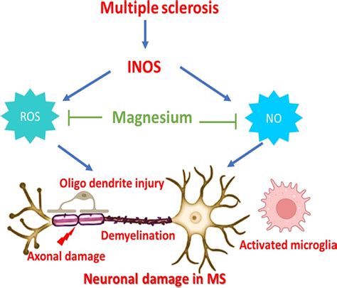 Multiple Sclerosis Induces The Inducible Nitric Oxide Synthase Inos
