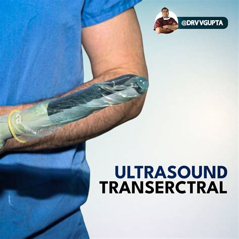 Transrectal Ultrasound In Delhi Govinda Lifecare