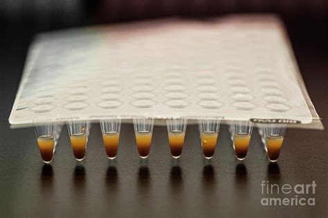 Dna Binding Beads Settling At The Bottom Of Wells In A Plate Photograph By Cdc Courtney Wheeler