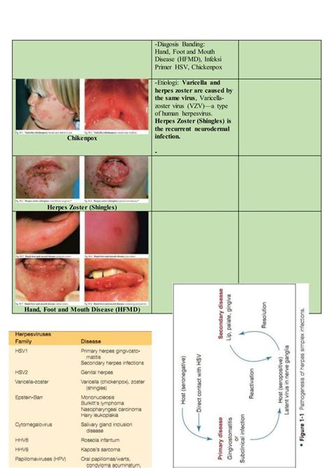 Lesi Rongga Mulut Akibat Virus Docx