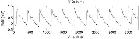 正常脉搏波形状图 脉搏波正常图示 脉搏波 大山谷图库