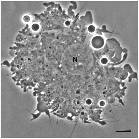 Morphological And Ultrastructural Characterization Of Hemocytes In An