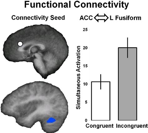 Figure 1 From The Neural Basis Of Stereotypic Impact On Multiple Social Categorization