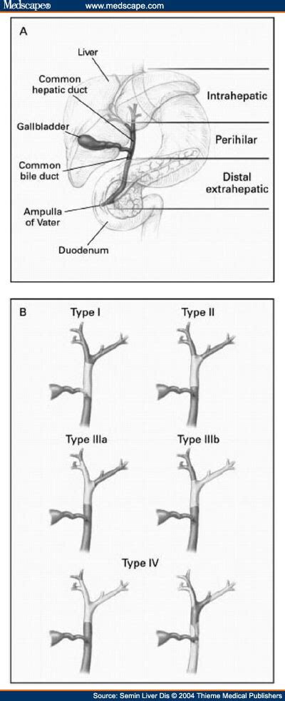 Endoscopic Management Of Cholangiocarcinoma