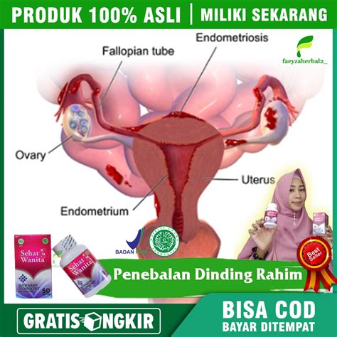 Gambar Dinding Rahim 52 Koleksi Gambar