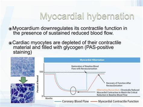Coronary Classpptx Free Download