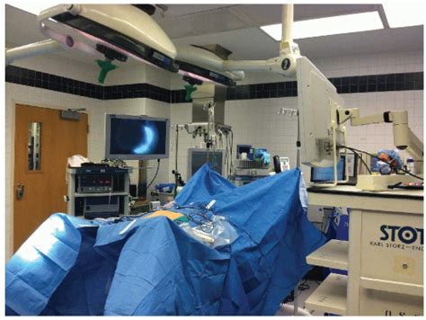 Laparoscopic Sigmoid Colectomy Abdominal Key