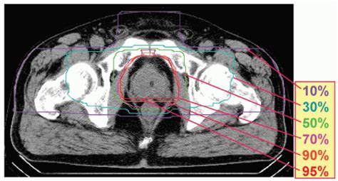 Prostate Radiology Key