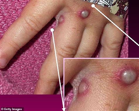 Gay And Bisexual Men Are Having Less Sex Because They Are Worried About