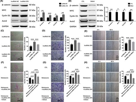 Wnt β‐catenin Signalling Pathway Was Involved In Lncrna Jpx Mediated Download Scientific