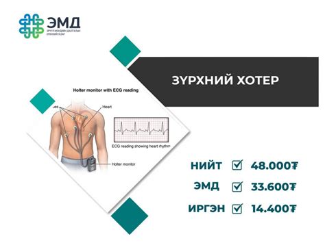 Артерийн даралт 24 цагийн хяналт зүрхний холтер 70 хувийг ЭМД ын сангаас хөнгөлнө Isee Mn