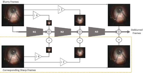 Figure 1 From Deblurring Cataract Surgery Videos Using A Multi Scale Deconvolutional Neural