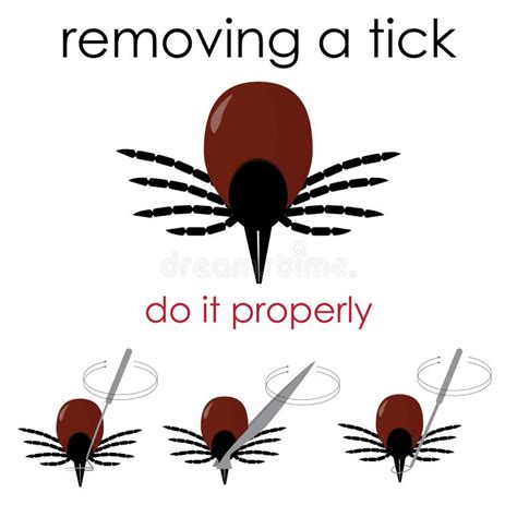 Removing A Tick Stock Vector Illustration Of Isolated 57214352