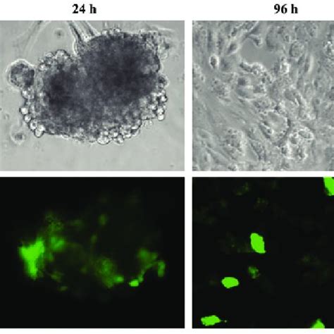Lentiviral Mediated Transduction Of Gfp Into Human Breast Organoids
