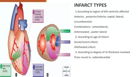 Ischemic Heart Diseaseihd Pptx