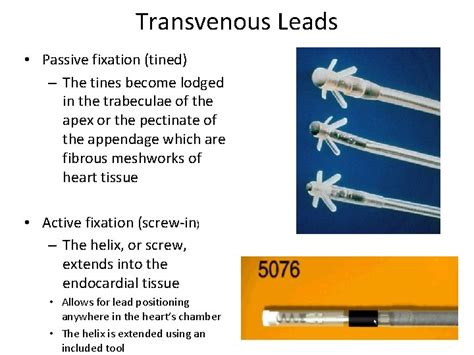 Basics Of Pacemaker Part 1 Dr Suresh S