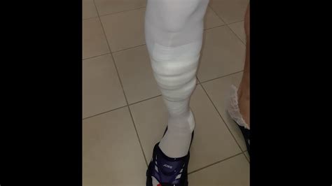 Операция варикоз - YouTube