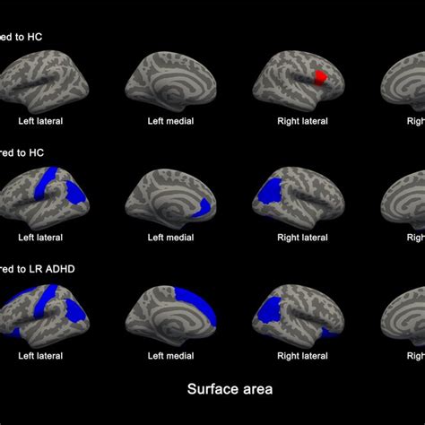 Cortical Regions Exhibiting Differences In Surface Area In High Risk