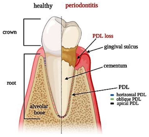Biomimetic 3d Scaffolds To Reproduce Periodontal Ligament Microenvironment Encyclopedia Mdpi