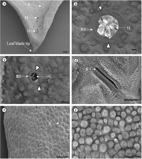 Scanning Electron Micrographs Of External Structures Of Hydathode And