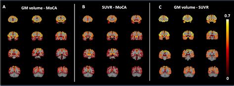 Figure 2 From Relationship Between Neuroimaging And Cognition In Frontotemporal Dementia A [18