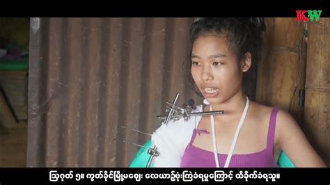 ကွတ်ခိုင်မြို့မဈေး လေယာဉ်ဗုံးကြဲခံရမှုမှ လွတ်မြောက်ခဲ့သူ မိန်းကလေး