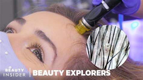 Remove Scalp Gunk With Hydrafacial Keravive Beauty Explorers Youtube