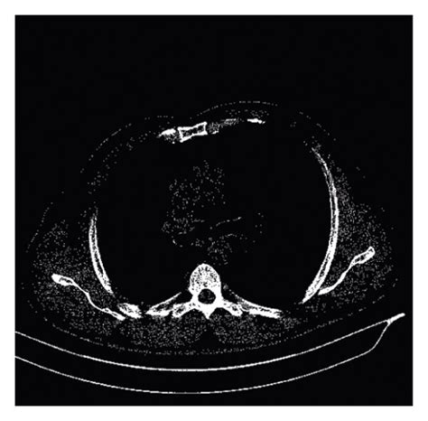 The Comparison Outcomes A Original Ct Image 5 B D Segmentation