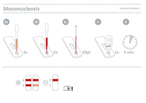 Mononucleosis Test Diagnostic Support