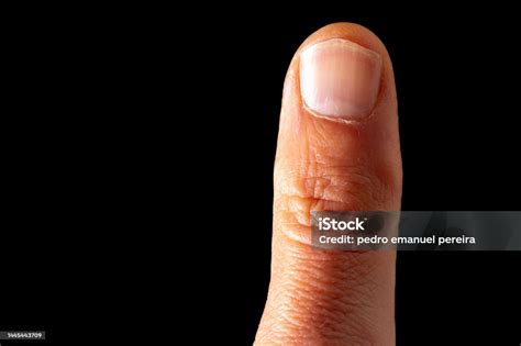 검은 배경 아래 이빨에 물린 손톱을 가진 인간의 손 엄지 손가락 손발톱곰팡이병에 대한 스톡 사진 및 기타 이미지 손발톱곰팡이병 건강관리와 의술 건강한 생활방식