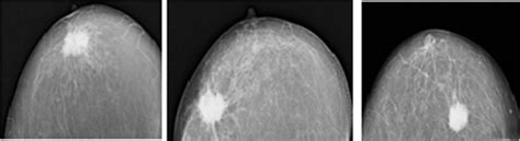 Sample 3 In House Clinical Dataset Input Image Download Scientific Diagram