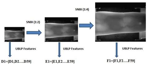 Vein Snbi Ulbp Features Representation Download Scientific Diagram