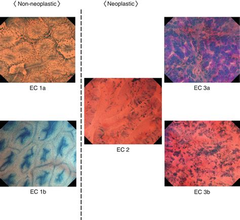 6 Endocytoscopy Abdominal Key