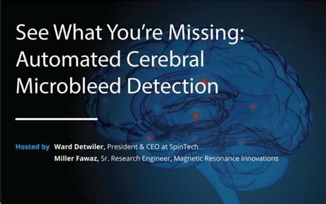 See What Youre Missing Automated Cerebral Microbleed Detection Webinar Spintech Mri