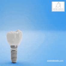 Implant S Tenor