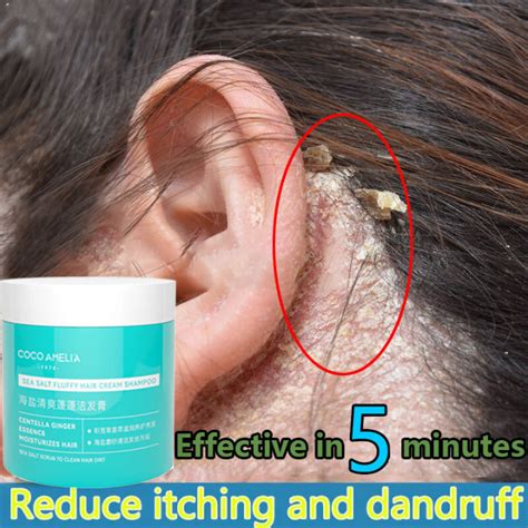 Cca Sea Salt Shampoo Anti Dandruff Refreshing Oil Control Deep Scalp Removal Mites Shampoo