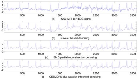 No 203 Mit Bih Ecg Signal De Noising Results Download Scientific Diagram