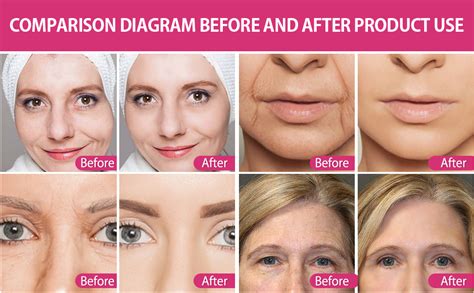 Face And Forehead Wrinkle Patches 192 Pcs Anti Wrinkle Patches For Face Overnight