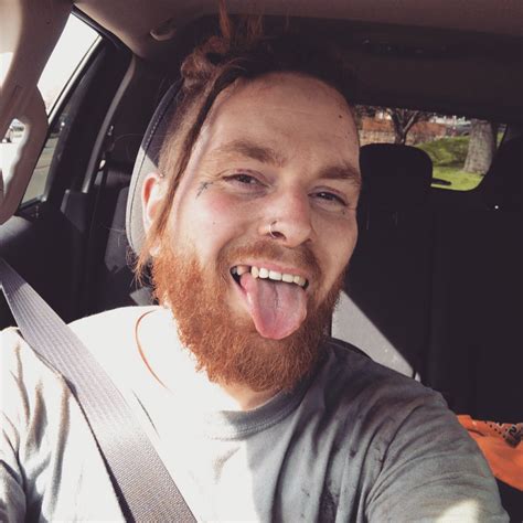 Ive Been Embarrassed About My Missing Tooth For A While So I Dont