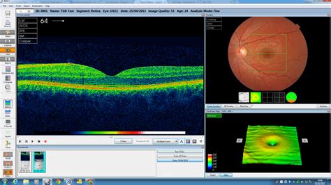 3d Oct Optical Coherence Tomography Opticians In Castlefordvisioncare