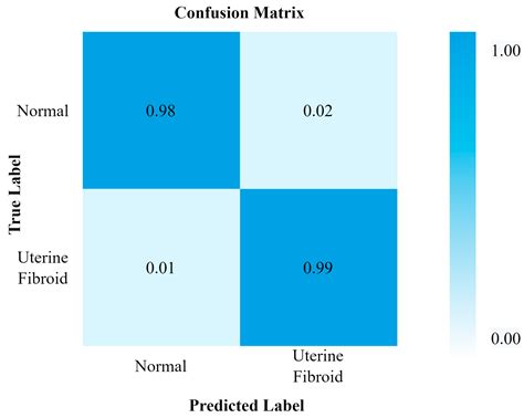 Automated Uterine Fibroids Detection In Ultrasound Images Using Deep Convolutional Neural Networks