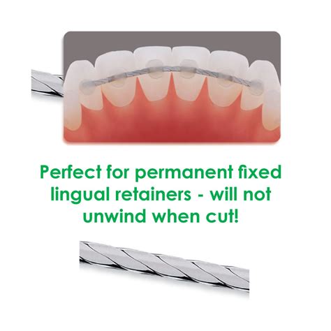 Ada Code For Fixed Ortho Retainer At Andrew Dow Blog