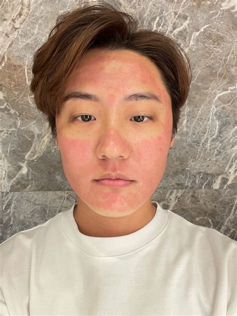 品牌理念分享 在上帝視角是我第一次和醫師面對面諮詢和討論治療計畫 上帝視角醫美診所