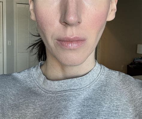 Update To Skin Texture Issue R30plusskincare