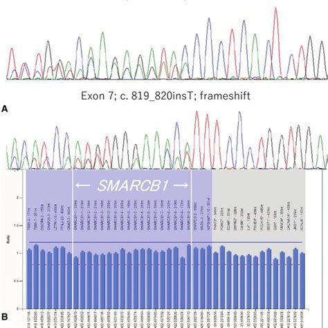 Molecular Genetic Analyses A Multiplex Ligation Dependent Probe Download Scientific Diagram