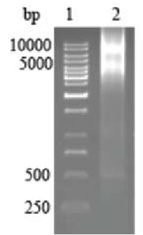 Amplification Of The Mouse Alpha Synuclein Gene Alpha Synuclein Was